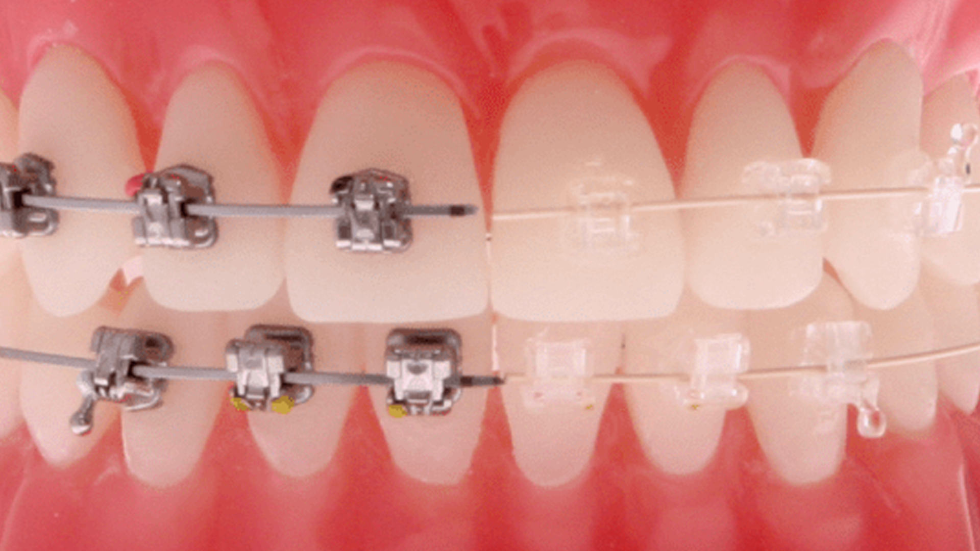 Ortodontia – Odonto Company