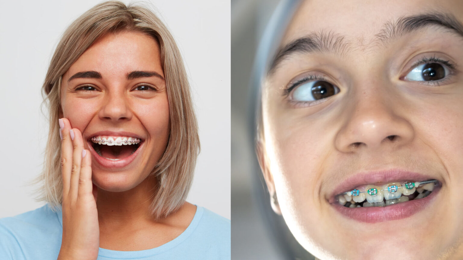 Ortodontia – Odonto Company